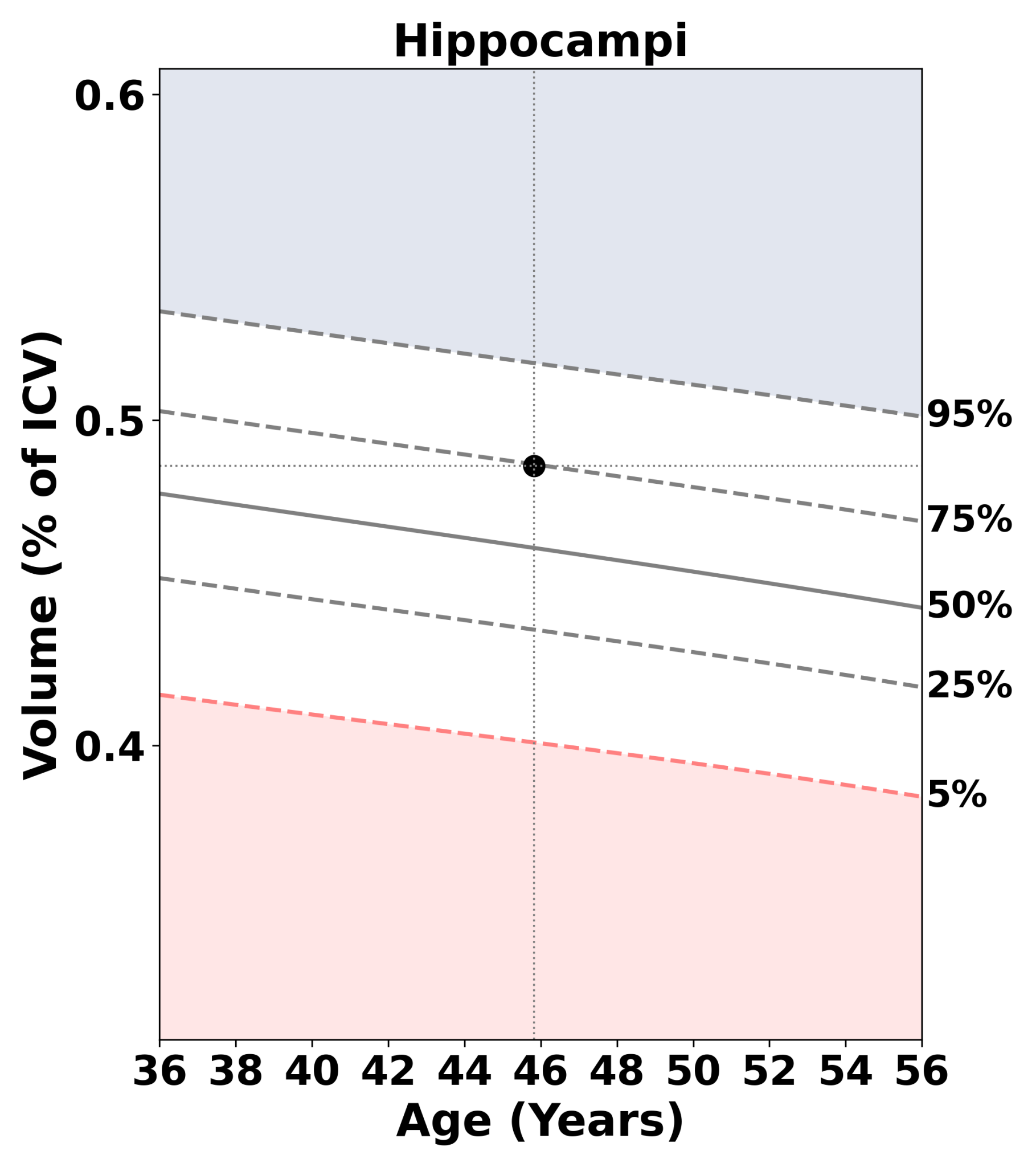 MRI Brain Imaging with NeuroQuant® for Dementia Assessment - Asiamedic ...